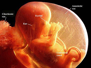 What Does Amniotic Fluid Look Like? | New Health Advisor